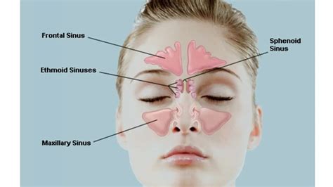 Apa Itu Sinus Kenali Jenis Jenis Fungsi Dan Penyakit Yang