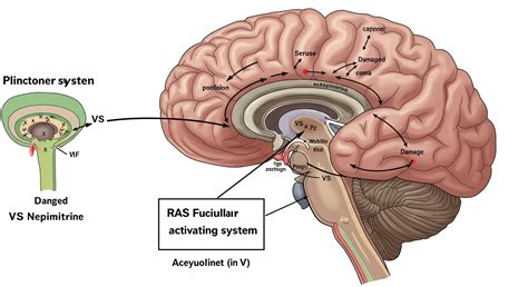 Coma Vs Vegetative State Key Differences Causes And Prognosis