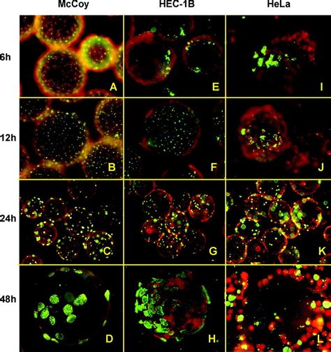 Chlamydia Trachomatis Microscopy