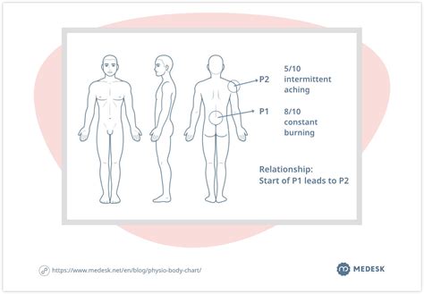Physiotherapy Body Chart Theory Examples And Recommendations