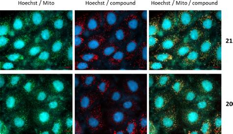 Analysis Of Subcellular Localization Of 20 And 21 Using Combined