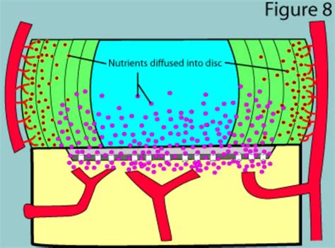 Disc Herniation Myths Farrelly Chiropractic