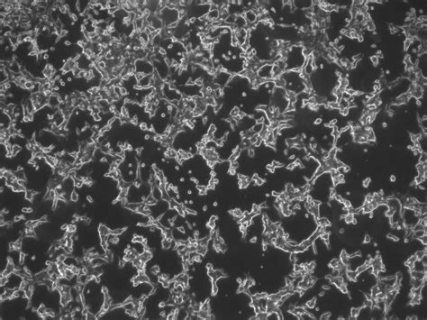 Why Are My Cells Not Surviving Puromycin Selection After Lentiviral