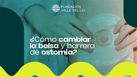 ¿cómo Cambiar La Bolsa Y Barrera De Ostomía Youtube