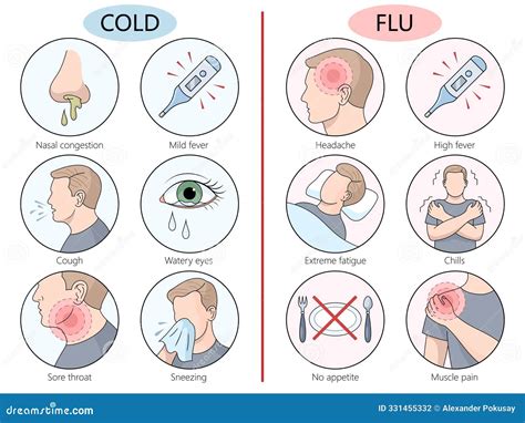 Comparison Of Cold And Flu Symptoms Medical Stock Illustration