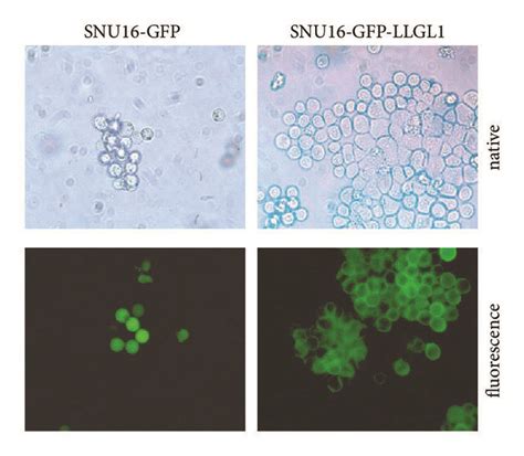 A Rt Pcr And Western Blot Confirms Successful Transfection Of Snu16