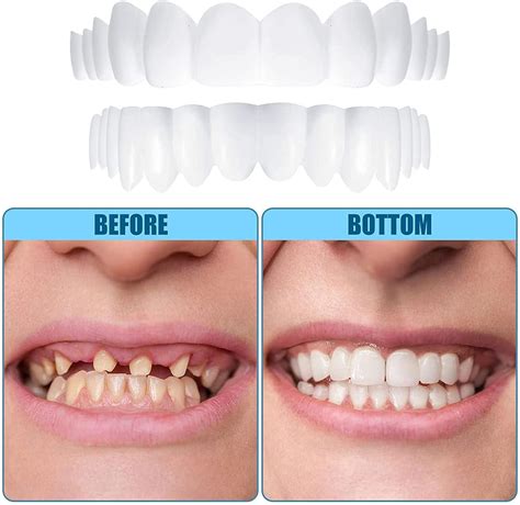Mxrfactory Teeth Prosthesis Pebble Gel Snap On Smile Temporary