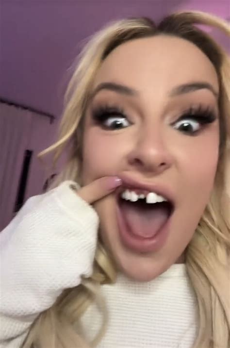 People Are Talking Allllll About Veneers After Tana Mongeau Posted A