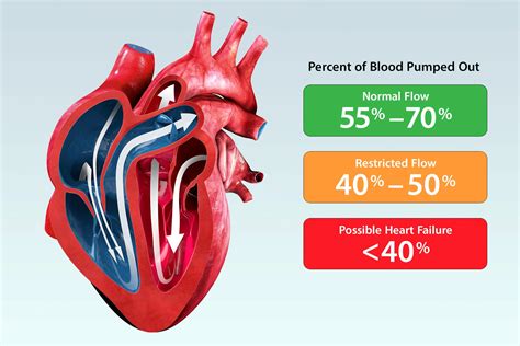Ejection Fraction Below 30 At Sofia Goldman Blog