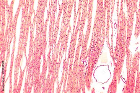 Foto De Heart Muscle Light Micrograph Striated Cardiac Muscle Cells