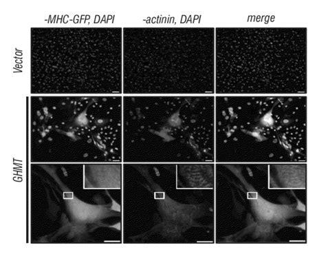 Cardiac Repair By Reprogramming Of Cardiac Fibroblasts Into Cardiomyocytes Eureka Patsnap