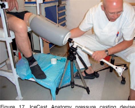 Figure 19 From Lower Limb Amputation In Patients With Vascular Disease