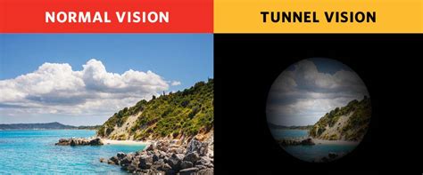 What Is Tunnel Vision Kodak Lens Vision Centre