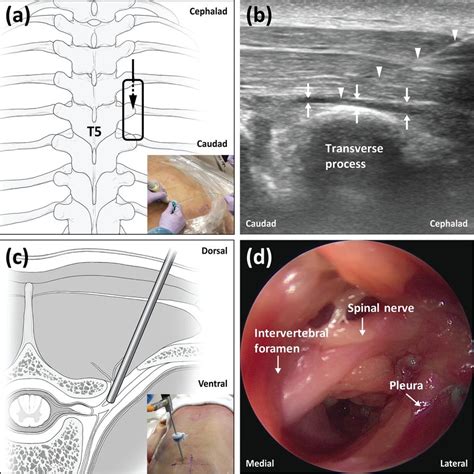 The Experimental Procedures For Injection And Endoscopy A Schematic