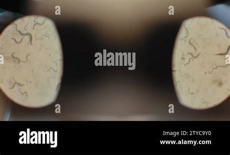 A Colony Of Microorganisms C Elegans Caenorhabditis Elegans Nematode Worms Under The