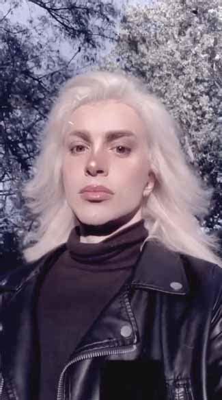 Luis Padrón Invierte Más De 85000 Euros En Operaciones Estéticas Para