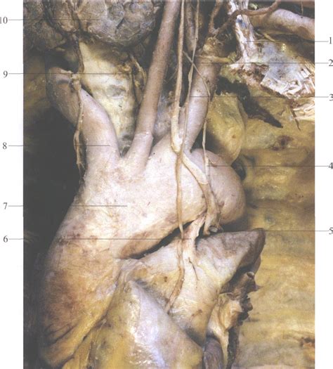 图20 401 左喉返神经1 口腔颌面及颈部临床解剖学
