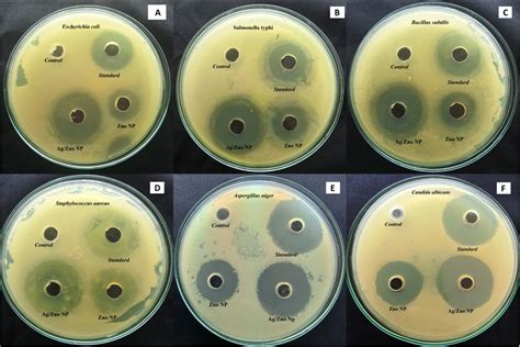 Agar Well Diffusion Assay Of A E Coli B S Typhi C B