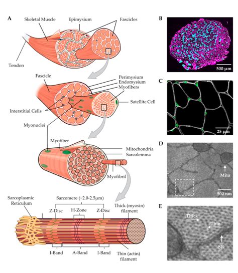 Muscle Hyperplasia