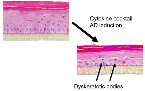 3d Atopic Dermatitis Model Non Artificial Human In Vitro Skin Tests