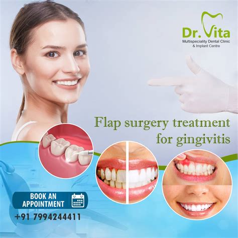A Gingival Flap Surgery Is Performed To Treat Gum Disease