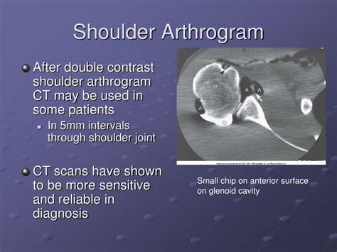 Ppt Arthrography Powerpoint Presentation Free Download Id 443478