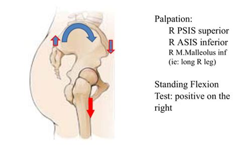 Lab 8 Sacroiliac Joint Pelvis Flashcards Quizlet
