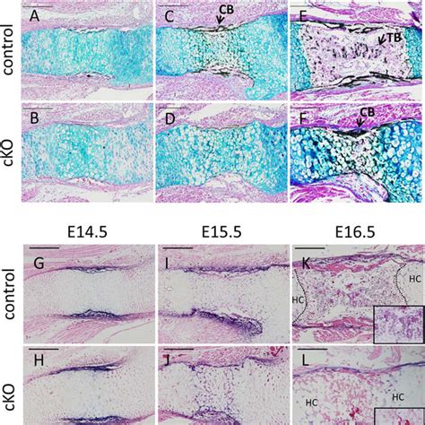 Sternal Abnormalities In Cko Mice Skeletal Preparations Of Control And