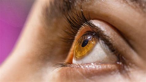 Exoftalmos Síntomas Causas Y Tratamientos