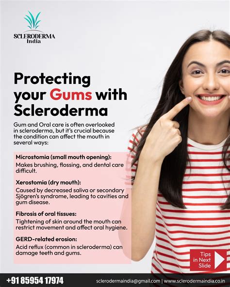 Scleroderma India