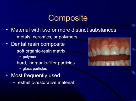 Composite And Acid Etching