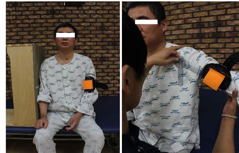 Measurement Of Forward Flexion Left Goniometer Right Smartphone Download Scientific