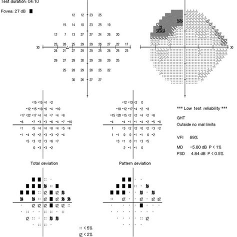 Humphrey Visual Fields 24 2 Notes Initial Tests A Right Eye Download Scientific Diagram