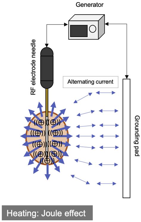 Tumor Thermal Ablation Enhancement By Micromaterials Pjlm