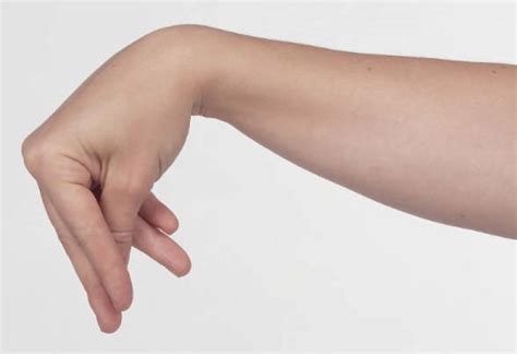 Carpopedal Spasm Definition Of Carpopedal Spasm