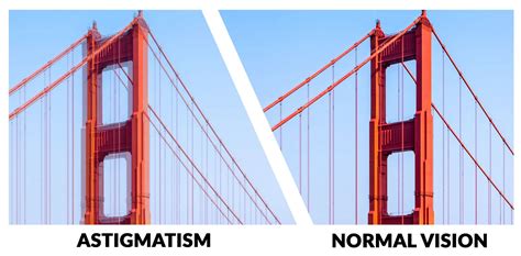 Astigmatism Optometrist In Kirkland Wa Eye And Contact Lens Center