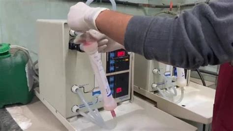 Diacare Solutions Dialyzer Reprocessing Machine For Haemodialysis At
