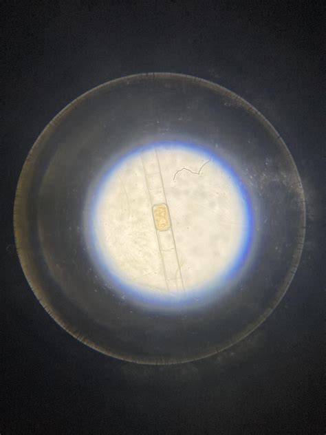 Is This An Algae Cell Ralgae