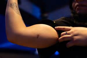 Marimar Martinez Shot By Border Patrol In Chicago Speaks Out After