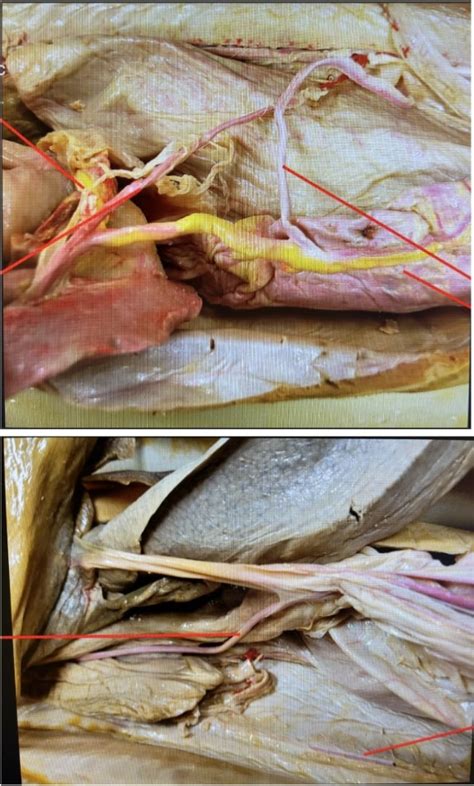 Vertebrates Lab 5 Anatomy Pt 9 Diagram Quizlet