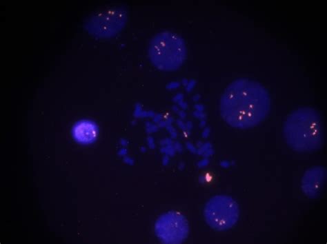 Molecular Cytogenetics Fish • Unistel