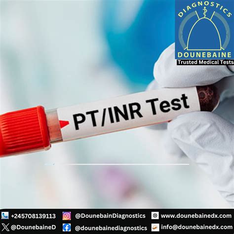 Prothrombin Time Test For Blood Samples Dounebaine Diagnostics Ltd