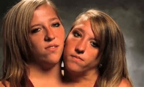 Soeur Siamoise Mariage