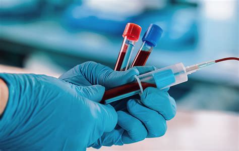 Tips For Avoiding Errors During Phlebotomy Specimen Collection Labtag