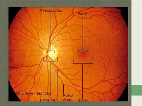 Anatomy Of Macula Pptx