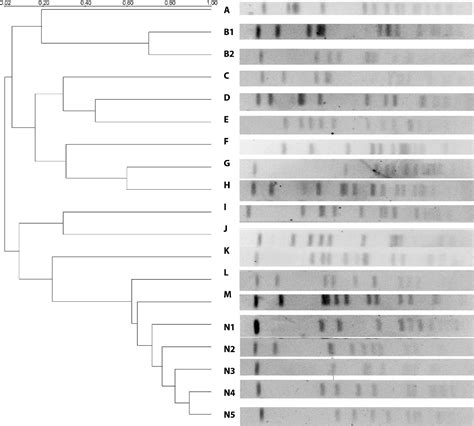 Molecular Typing Of Staphylococcus Aureus Strains From Ovine Mastitis By Pulsed Field Gel