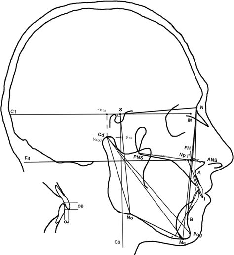 Sagittal Cephalometric View Showing Reference Parameters Points