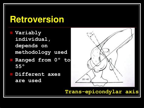 Ppt What Is In Shoulder Arthroplasty Powerpoint Presentation Free