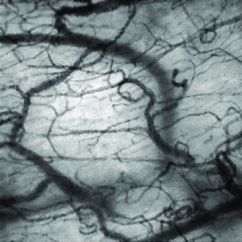 High Quality Image Of The Sublingual Microcirculation Obtained By Means Download Scientific