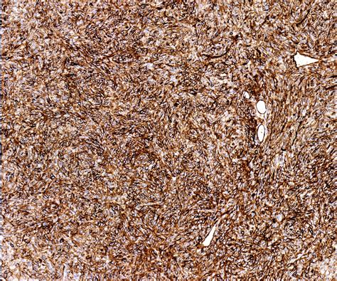 Appropriate Tissue Block Antibody Lexicon